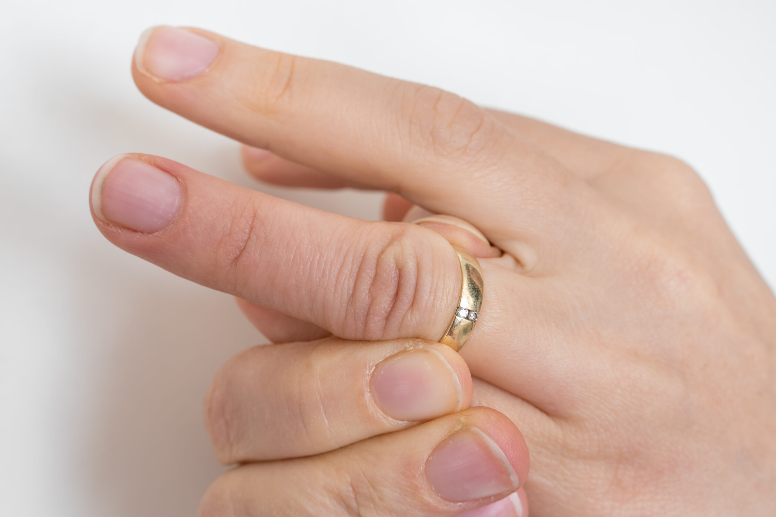 Wedding ring finger swelling | Beachweddingtips.com